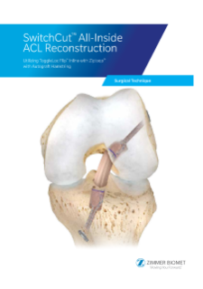 ToggleLoc® Flip Inline with ZipLoop® Technology | ACL Suspensory Button Fixation System